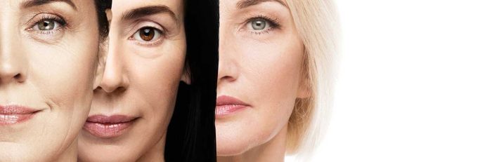 Resurfacing Facial con Lumenis M22 I Láser Resurfacing