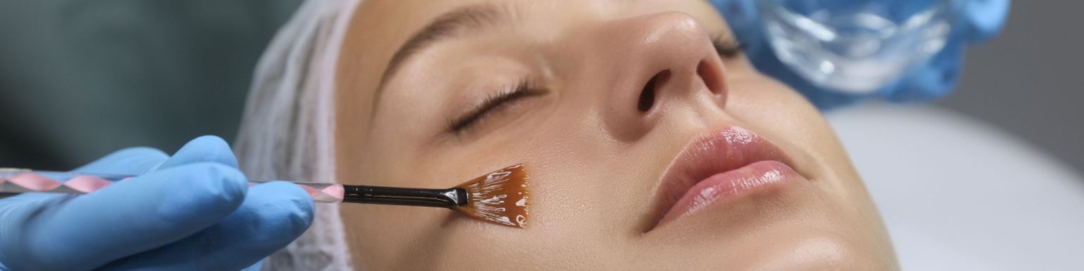 Peeling de fenol: ¿Qué es? y ¿por qué lo usamos para tener una piel más ...